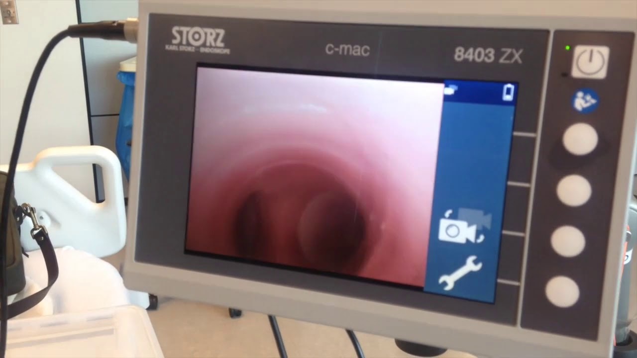 Endotracheal tube position check using a bronchoscope - YouTube