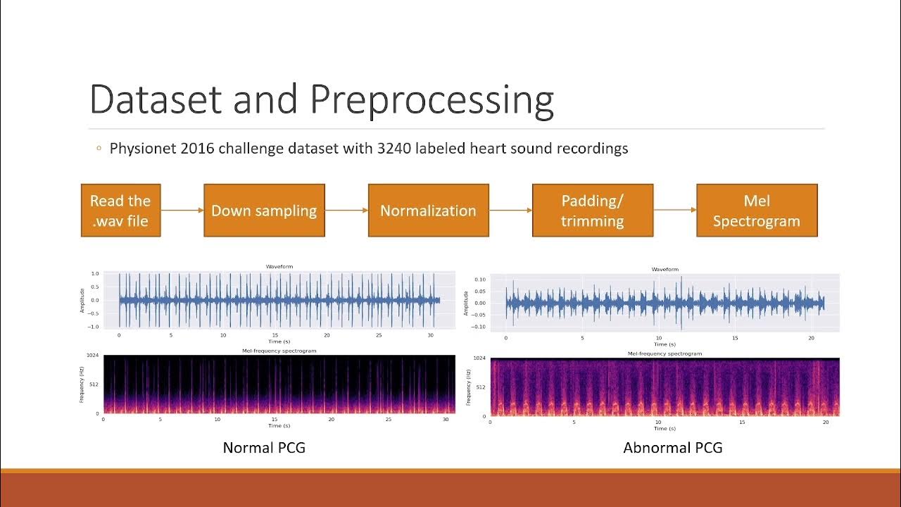 GR 325 - Early Heart Disease Detection Using Mel-Spectrograms and Deep Learning - YouTube