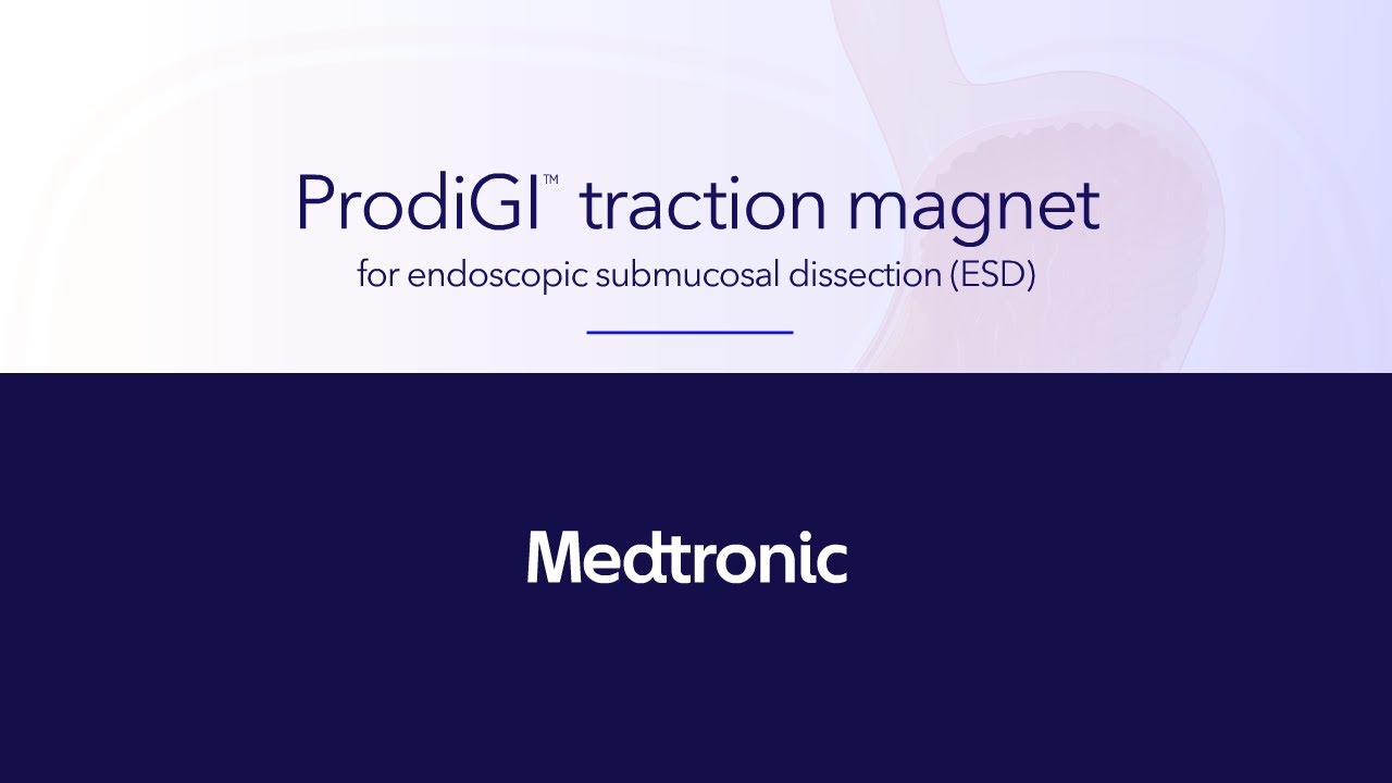 ProdiGI Traction Magnet Procedure Animation - YouTube