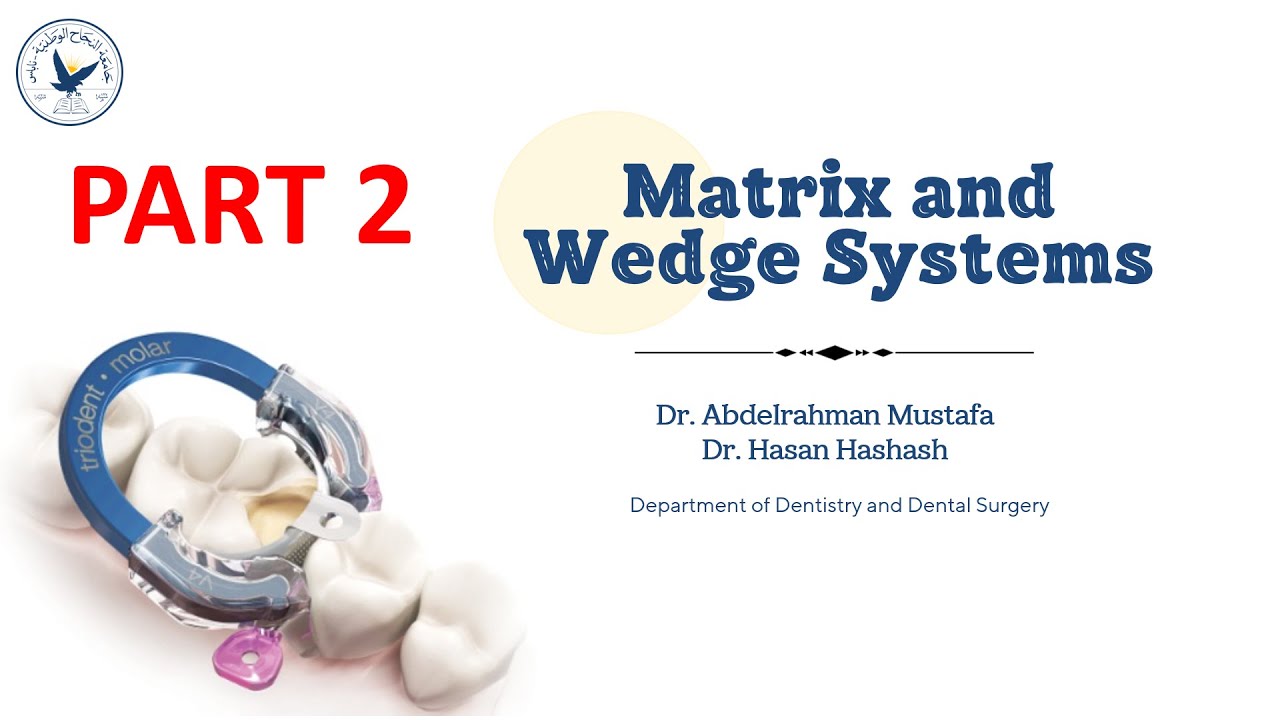 Matrix and Wedge Systems - Part 2/3 (Walser-Modern Circumferential ...