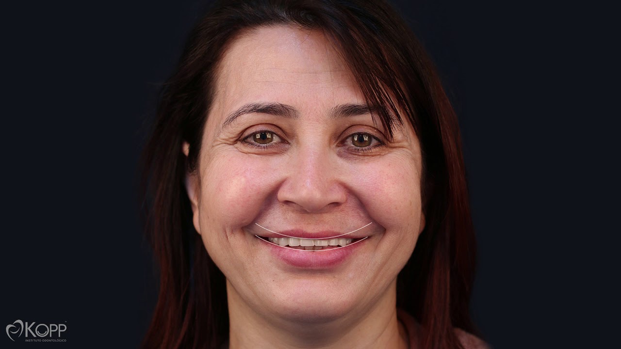 TRANSFORMANDO SORRISOS E VIDAS - YouTube