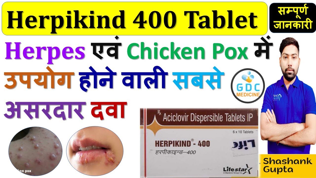 Herpikind 400 Tablet की सम्पूर्ण जानकारी|Herpes व Chicken Pox में ...