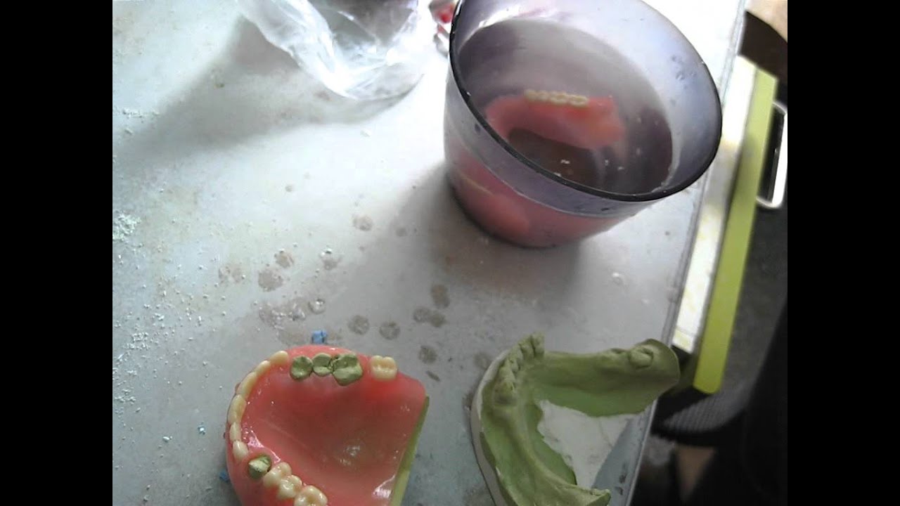 versacryl verginia partial denture 2 - YouTube