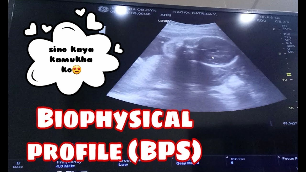 BIOPHYSICAL PROFILE FOR PREGNANT WOMAN CHECKING MY AMNIOTIC FLUID