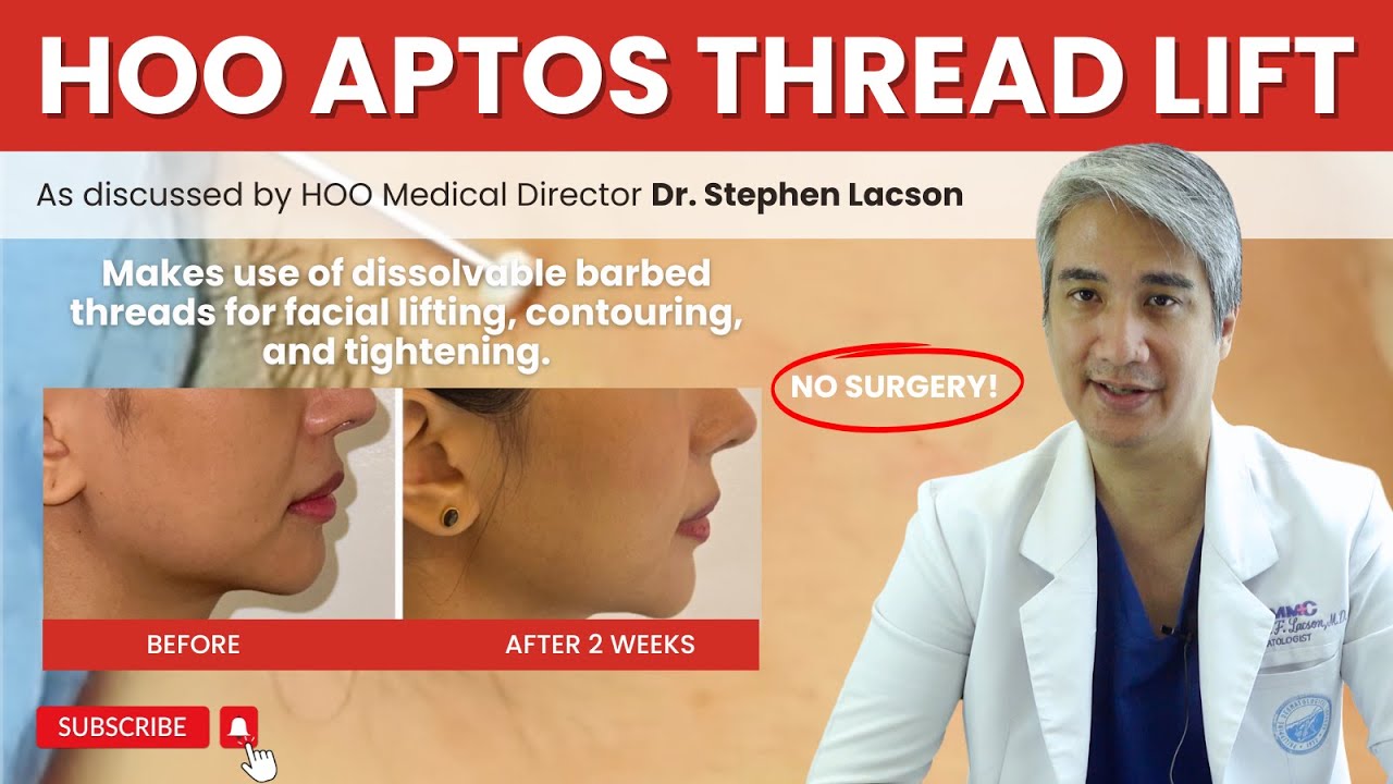 APTOS THREAD LIFTING - YouTube