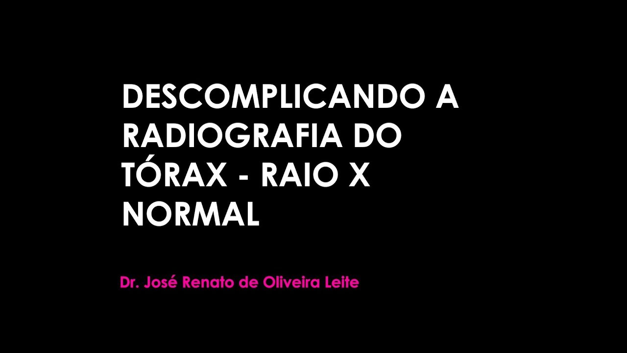 DESCOMPLICANDO A RADIOGRAFIA DO TÓRAX - RAIO X NORMAL - YouTube