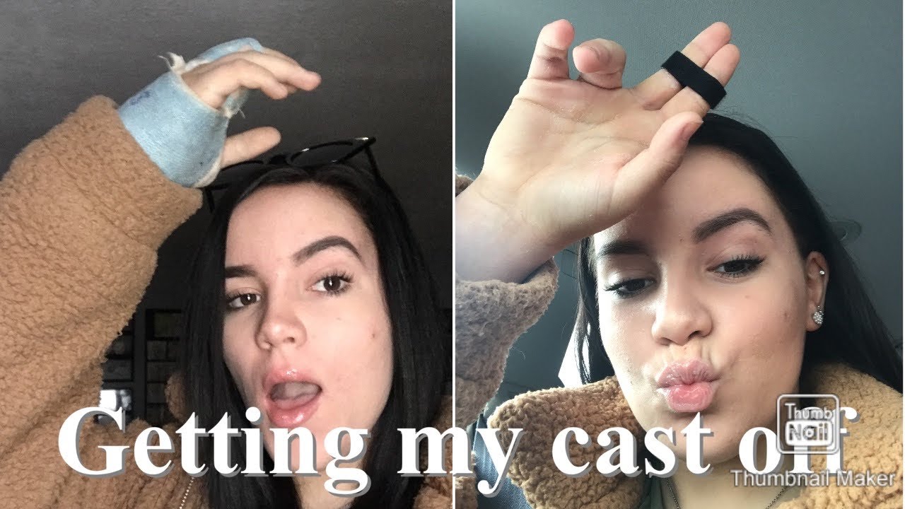 Getting My Cast Off 2019 - YouTube