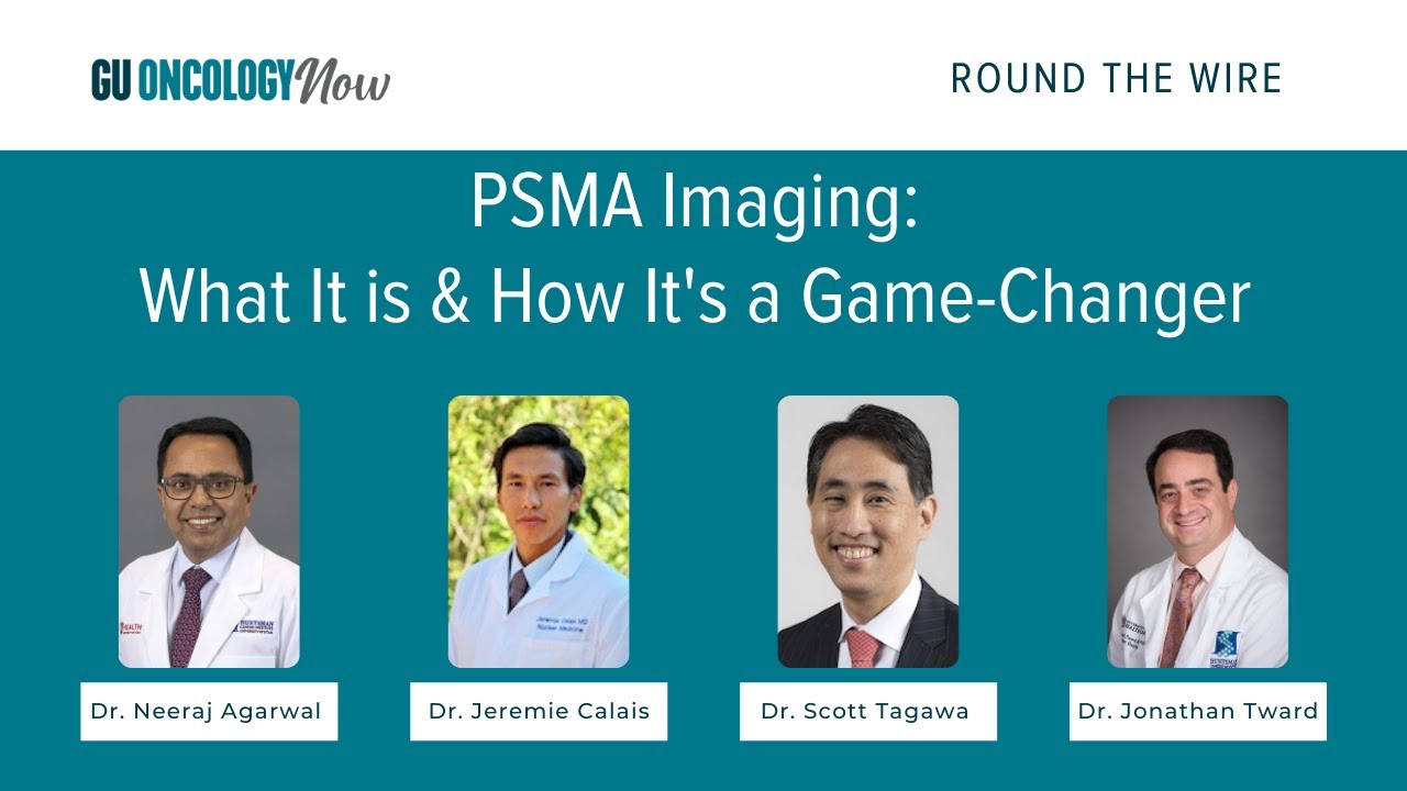 PSMA Imaging: What It Is and How It’s a Game Changer - YouTube