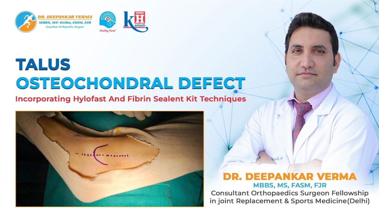 From diagnosis of Talus Osteochondral Defect to a Partial Hip ...