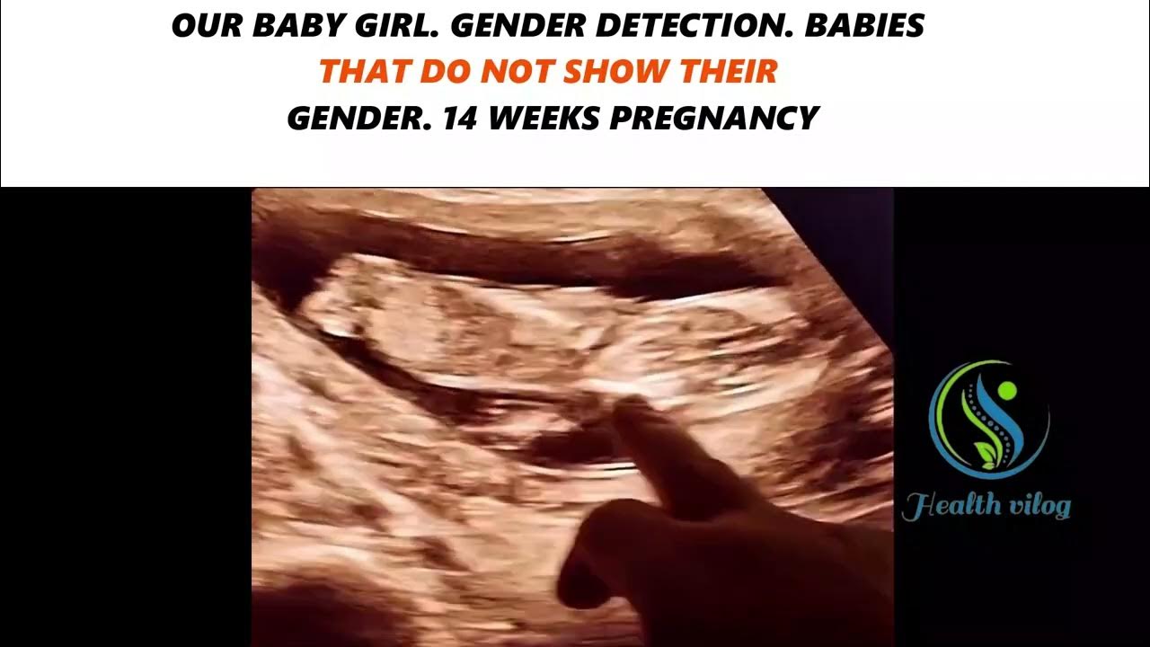 OUR BABY GIRL. GENDER DETECTION. BABIES THAT DO NOT SHOW THEIR GENDER. 14 WEEKS PREGNANCY # ...