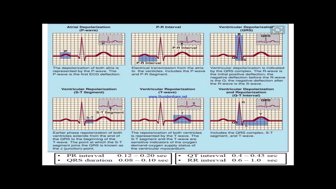 Normal And Abnormal ECG YouTube