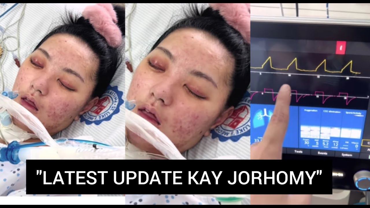 Andrew Schimmer latest update kay Jorhomy Rovero! - YouTube