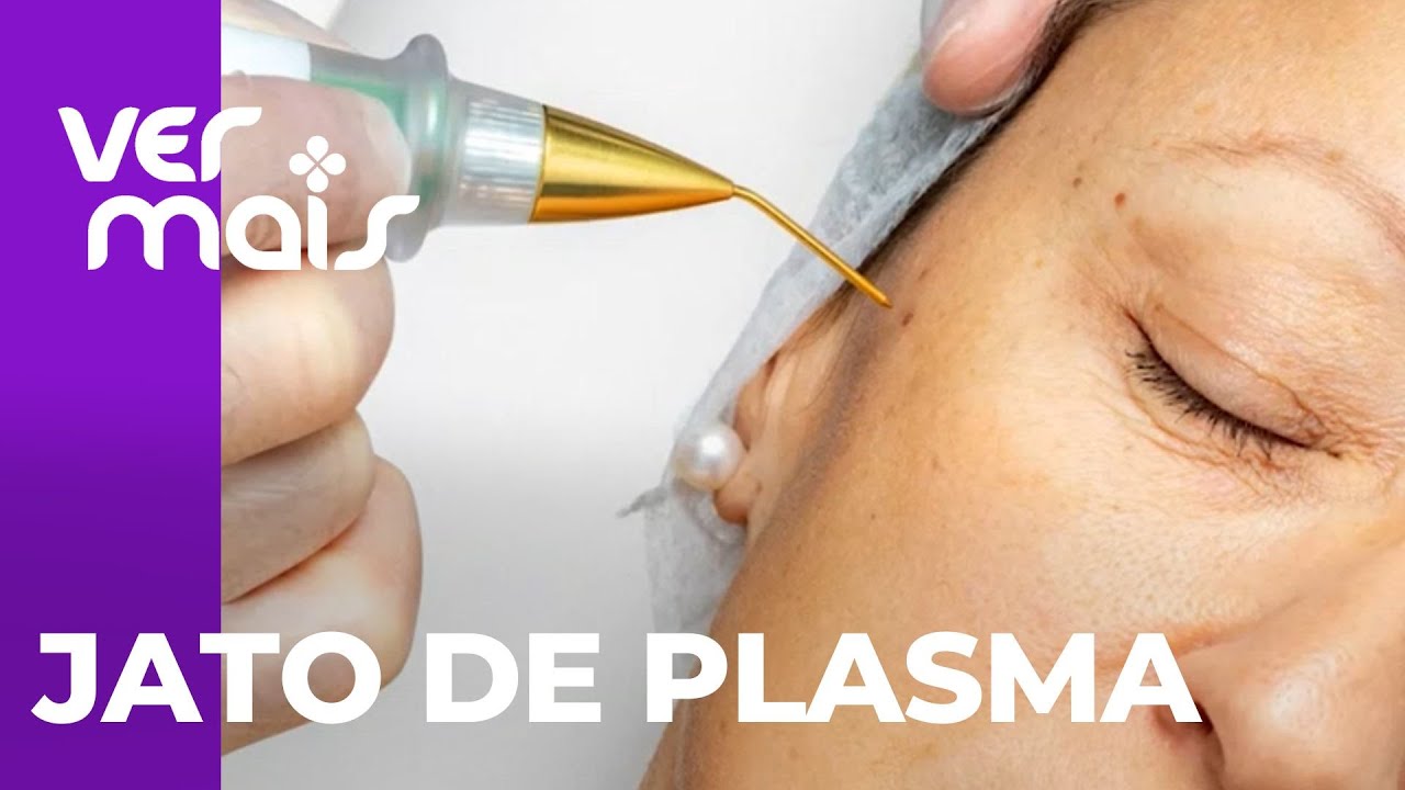Veja como acabar com as pintas de forma definitiva - YouTube