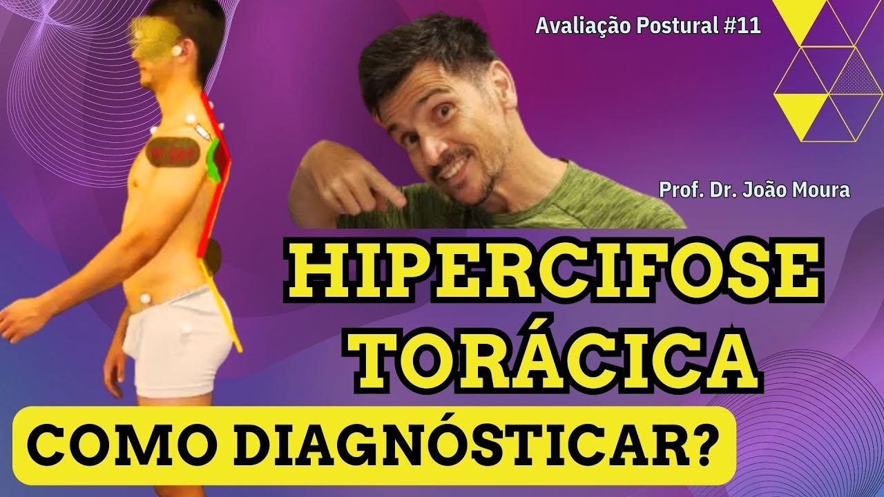 COMO DIAGNOSTICAR A HIPERCIFOSE TORÁCICA SEM ERRO? Avaliação Postural ...