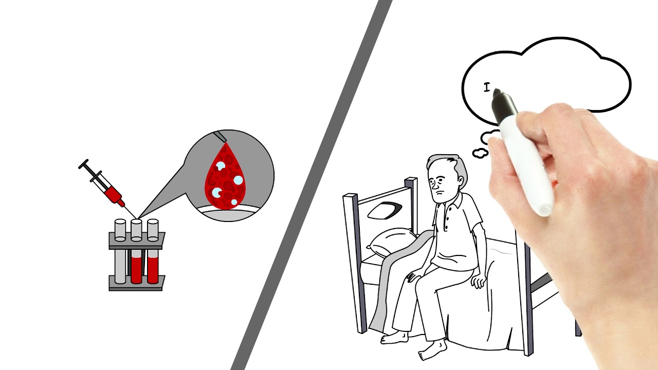 Our CLL Journey: (1) What is CLL? - YouTube