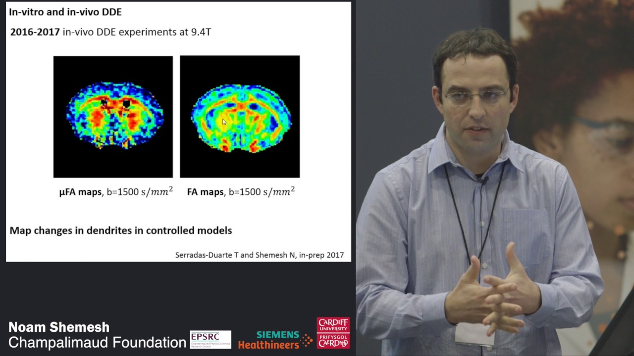 Pre-clinical Double Diffusion Encoding - Noam Shemesh - YouTube