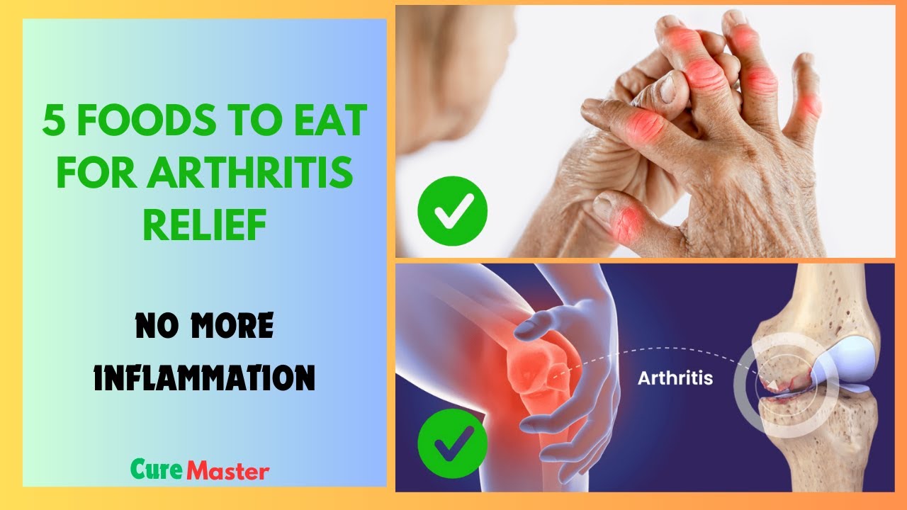 5 FOODS TO EAT FOR ARTHRITIS RELIEF | HEALTH TIPS - YouTube