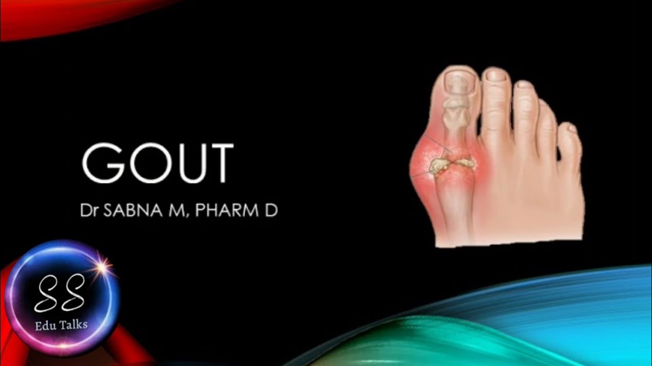 Gout- Definition, Risk factors, Pathophysiology, Clinical features ...