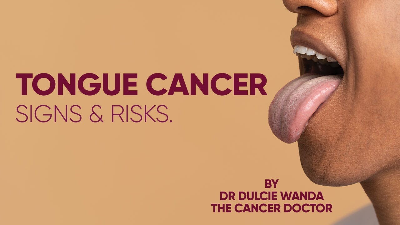 Tongue Cancer Uncovered: Signs, Risks, and What to Do Next - YouTube