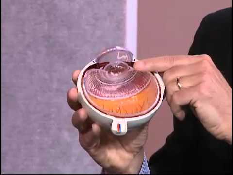 For Your Health with Dr Paul Wasson, Cataract Surgery 032416 - YouTube