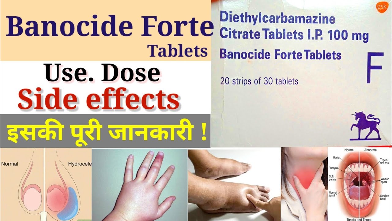 Banocide Forte tablet | Benefits Dose & Side effects | Review in Hindi ...