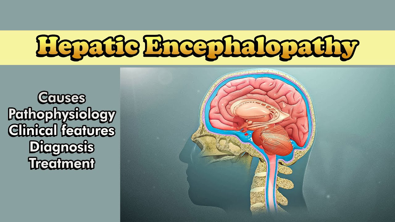 Hepatic Encephalopathy: Pathophysiology, Clinical Features, Diagnosis ...
