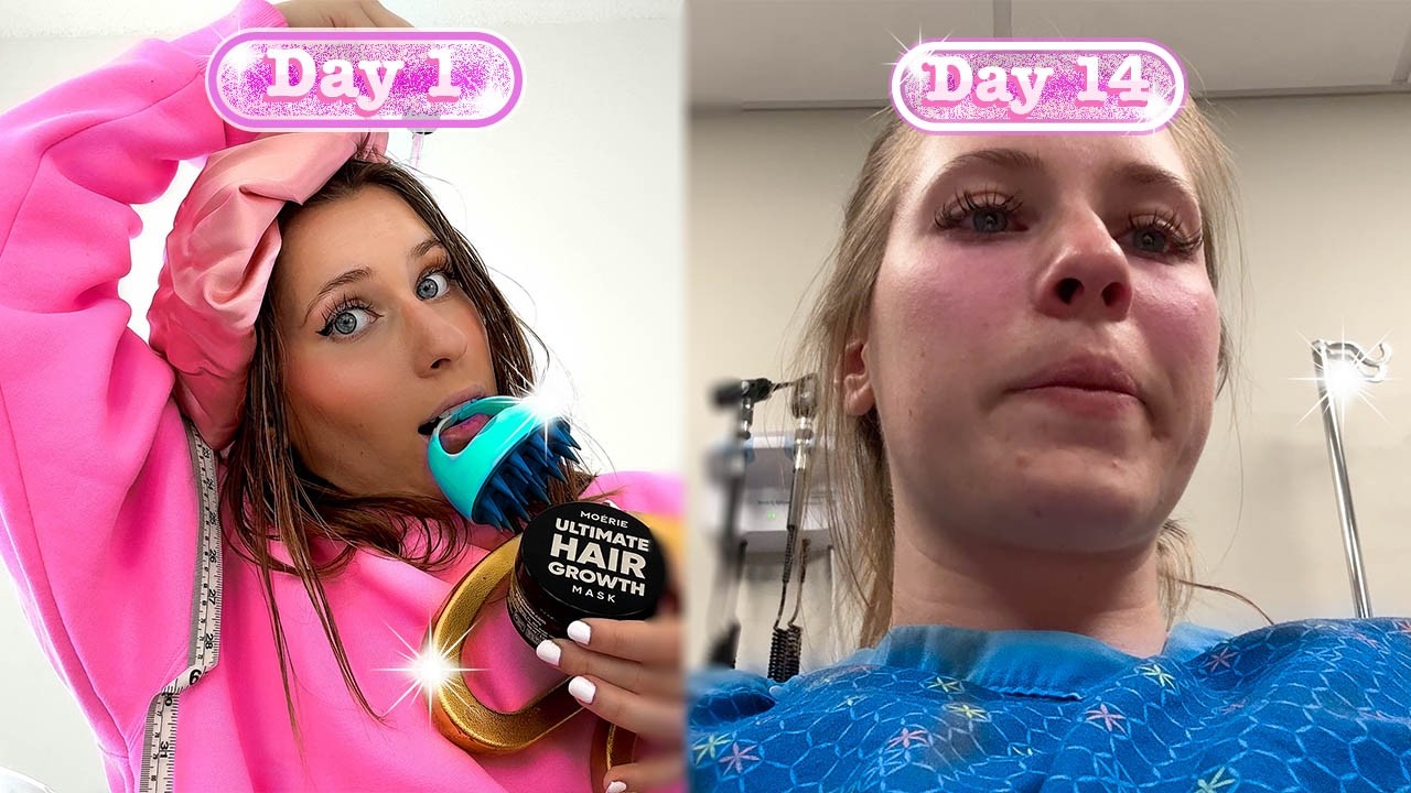 I Tested EVERY Hair Growth Hack at ONCE - YouTube