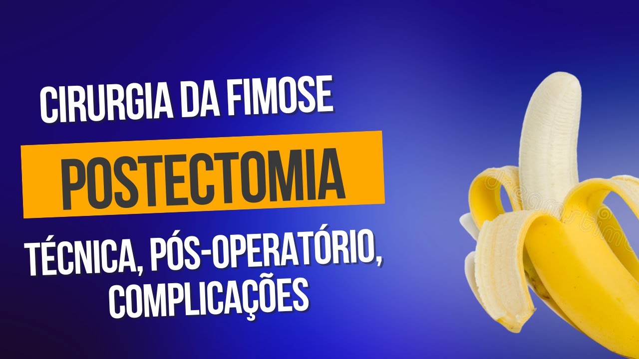 O que você precisa saber sobre a POSTECTOMIA - a cirurgia da fimose ...