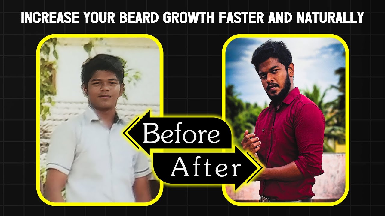 HOW TO GROW A BEARD FASTER NATURALLY | Grooming Tips | RABIRAJ'S ...