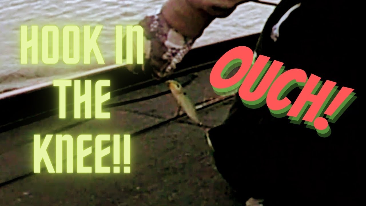 Painful Bass Fishing BLOOPERS - Hook in the KNEE! 🎣😱#bassfishing # ...