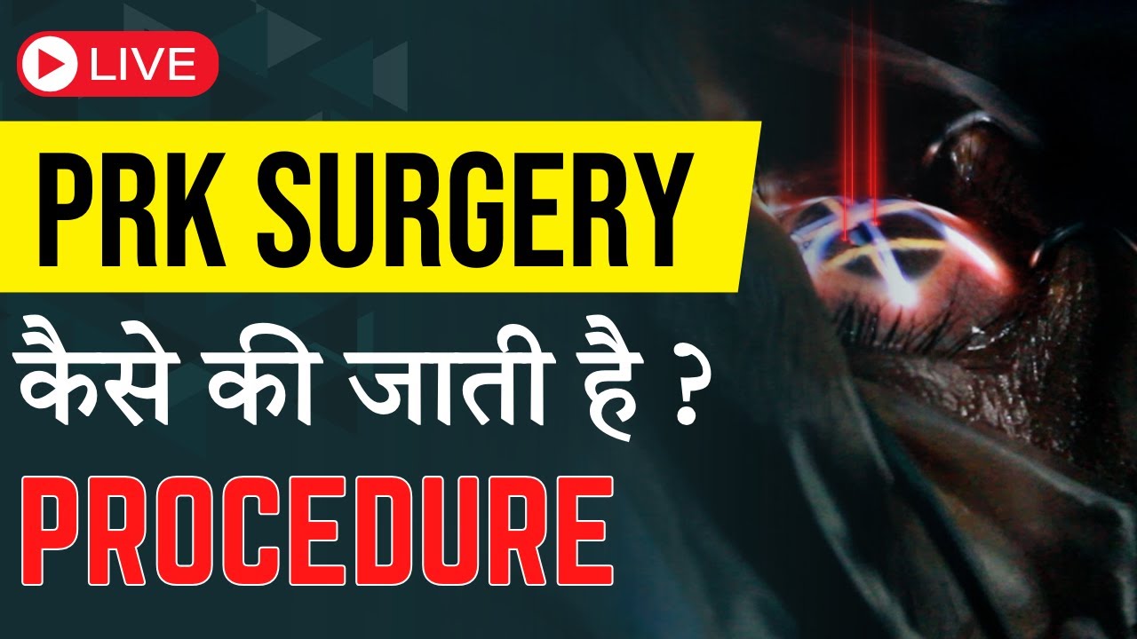 Live PRK Surgery | Step-by-Step PRK LASIK Procedure Explained 👁️ - YouTube