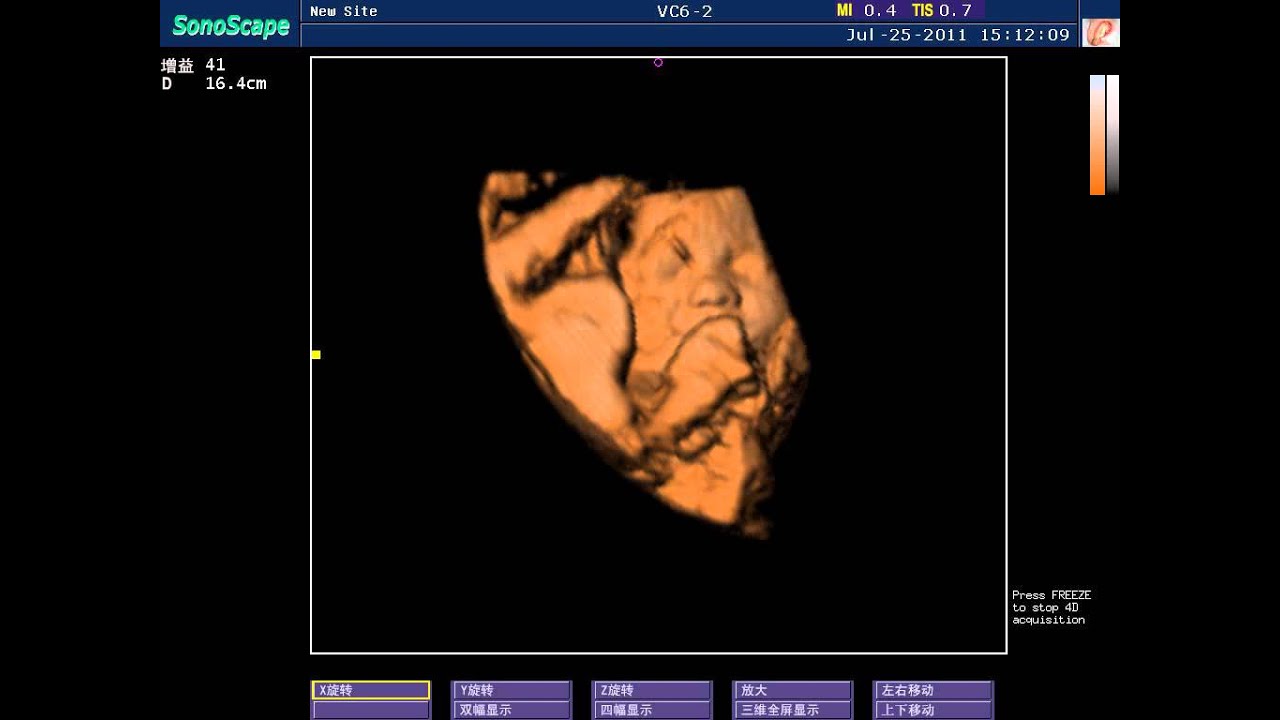 Color Doppler Ultrasound Sonoscape S8 | Demo of 4D Function - YouTube