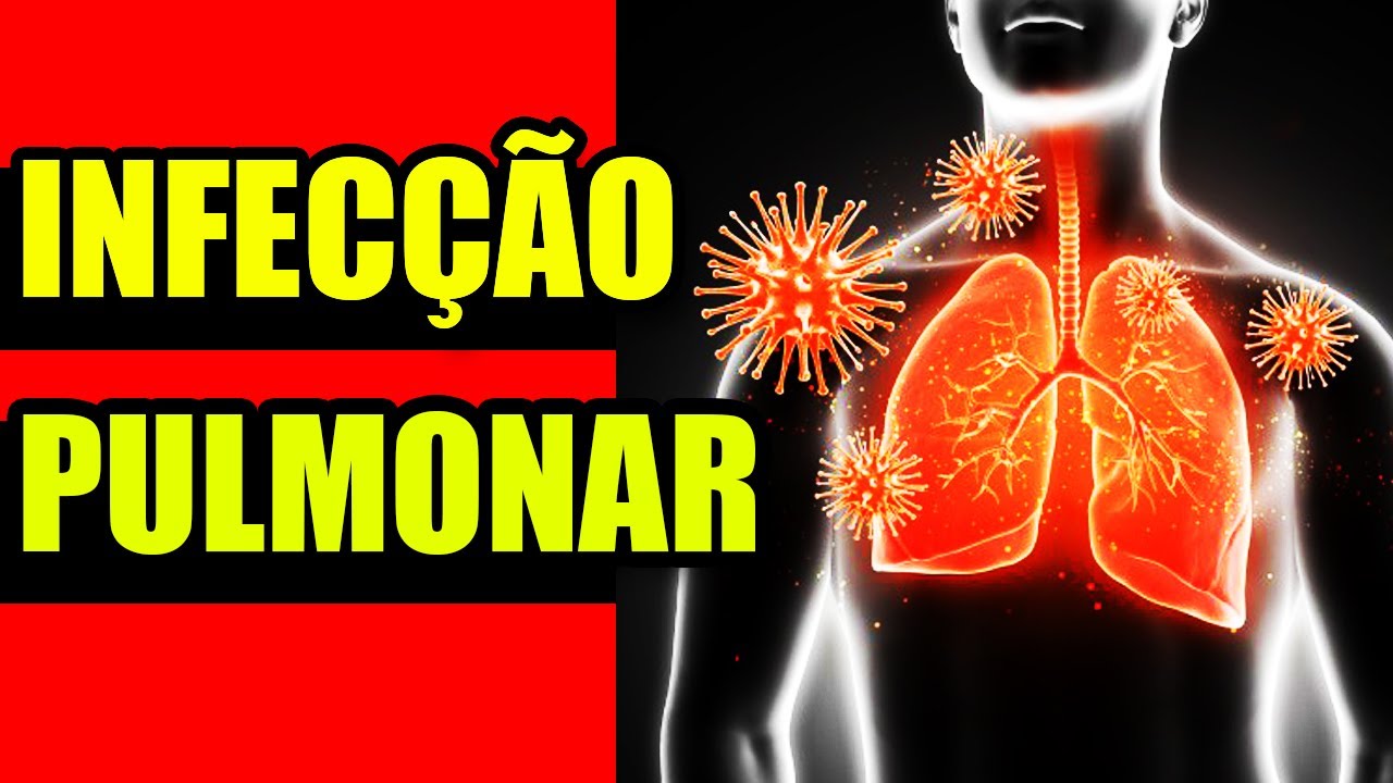 🔴INFECÇÃO PULMONAR - o que é, principais causas e tipos de Infecção ...