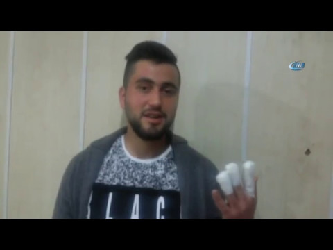Havai Fişek Elinde Patladı