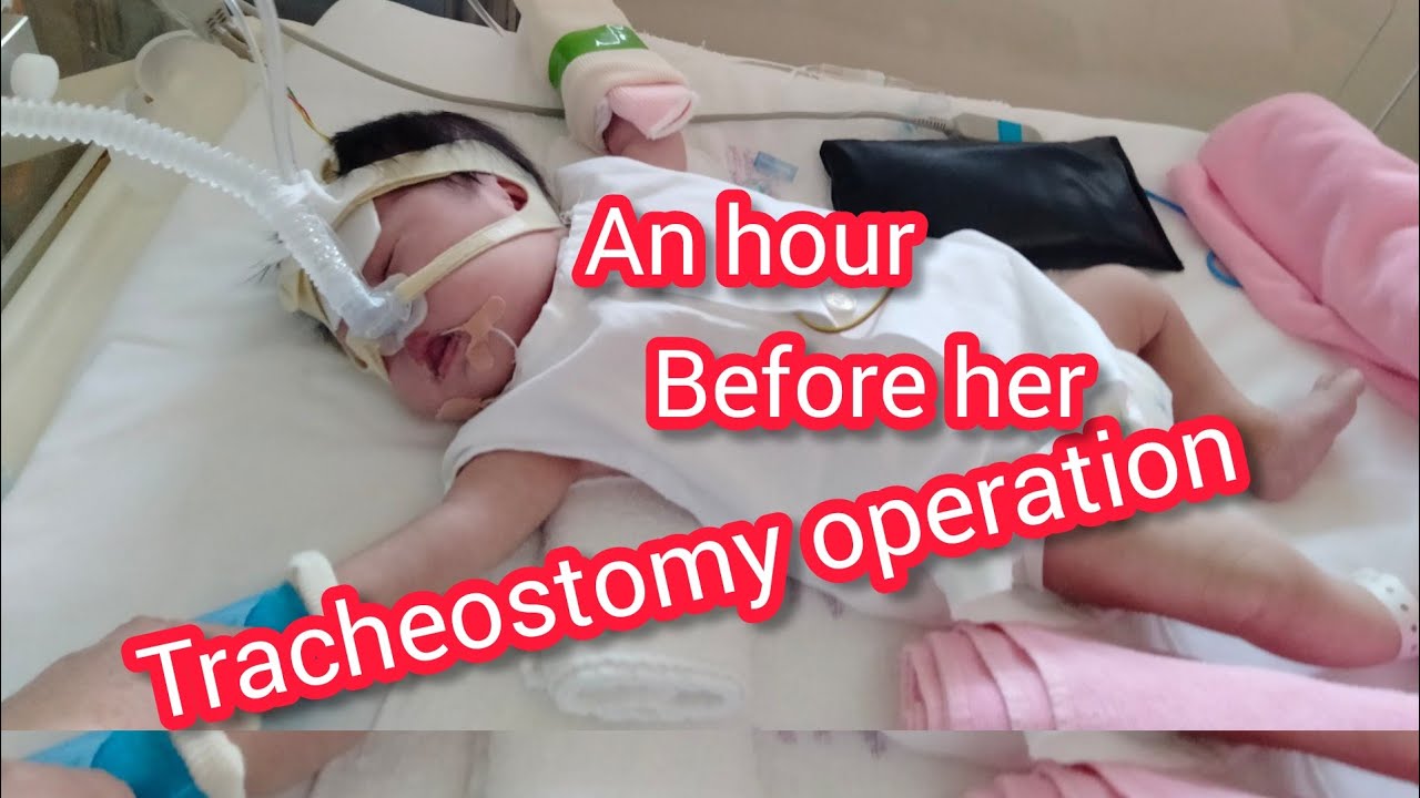 an hour before her tracheostomy operation - YouTube