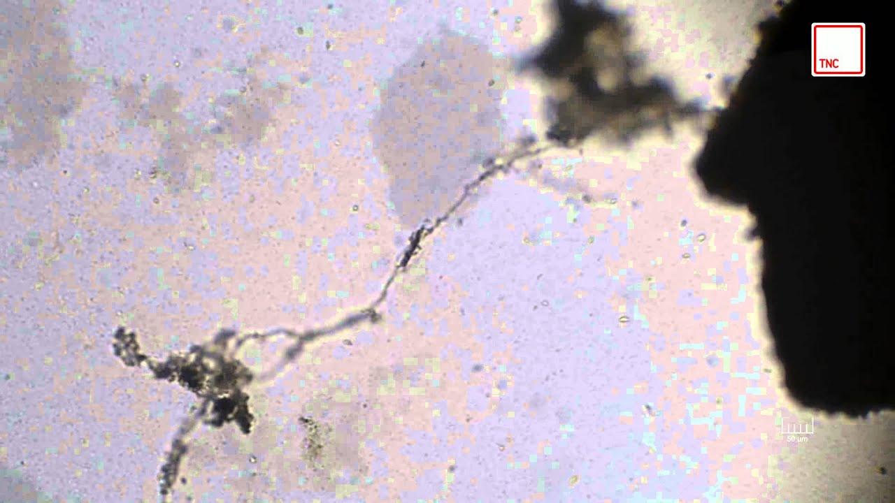 Compost Tea sample under microscope - CFT140520-40 - YouTube