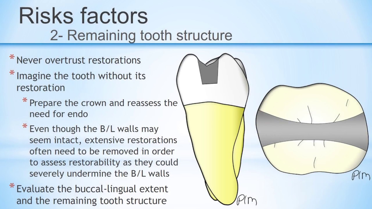 Evaluation of need for pre-prosthetic endodontic therapy - YouTube