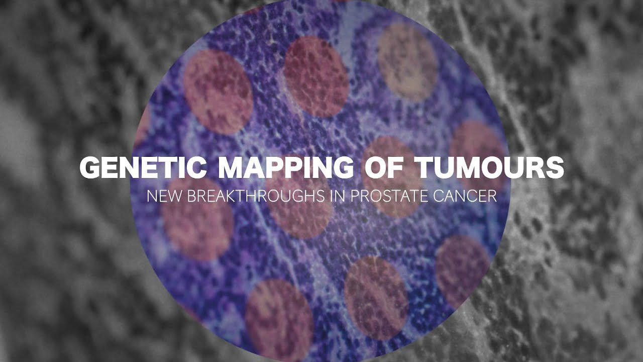 Genetic mapping of tumours: New breakthroughs in prostate cancer - YouTube