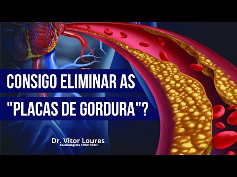 Consigo eliminar as \