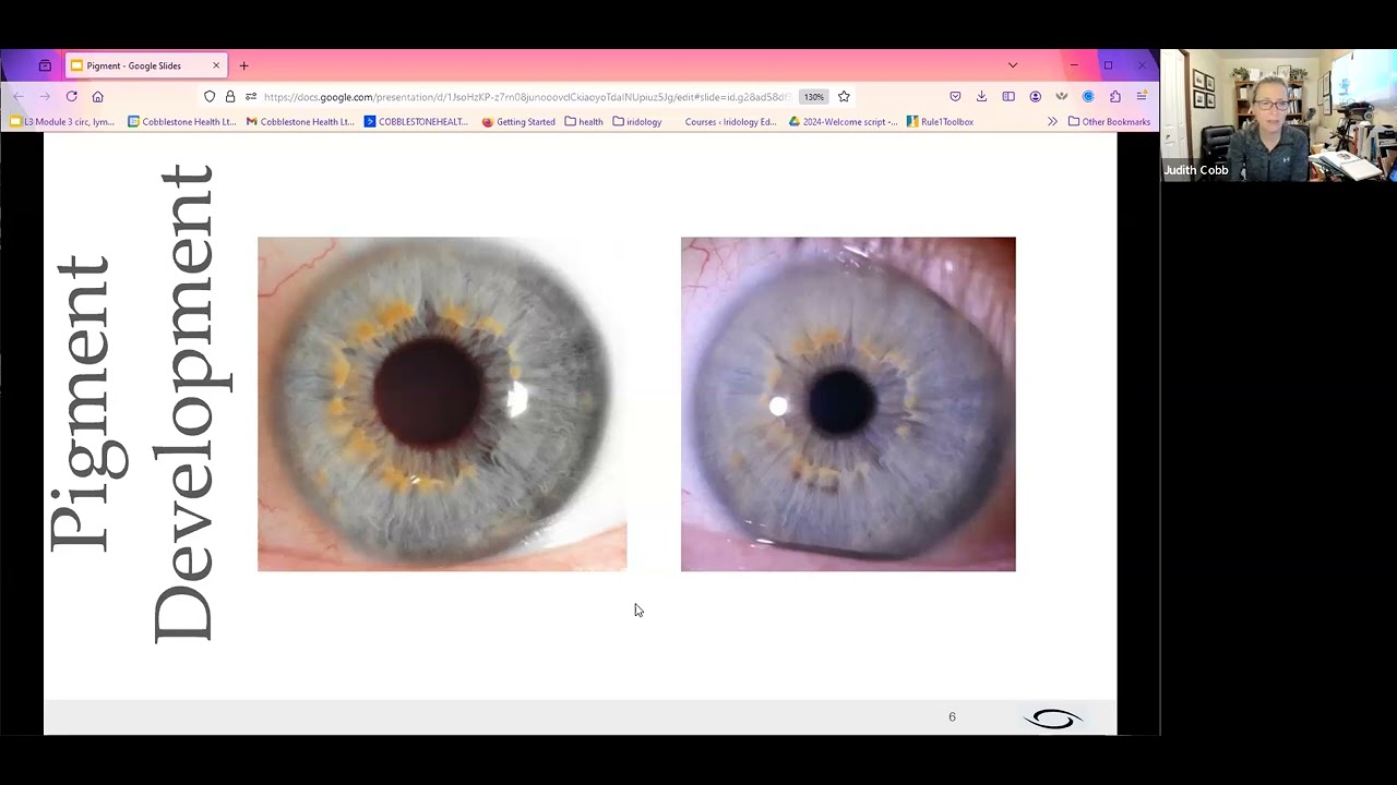 Iris Pigments - what they mean - YouTube