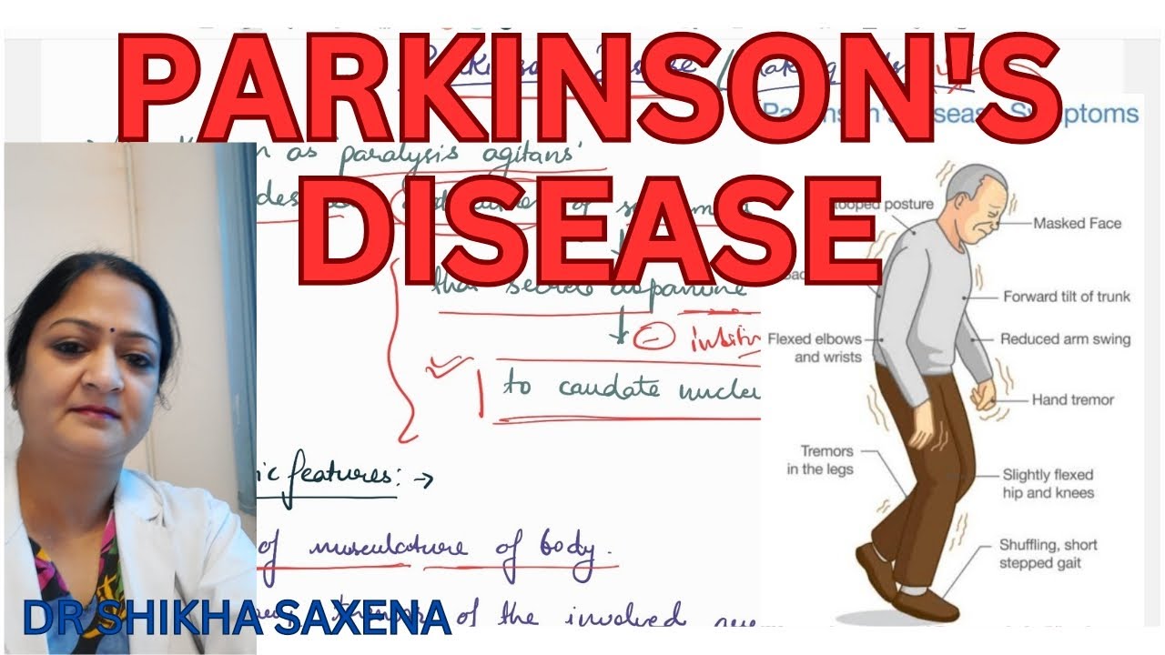 Parkinson's Disease, Akinesia, Rigidity, Tremors - YouTube