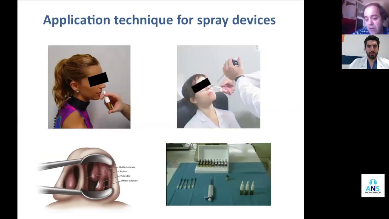 Nasal Allergen Challenge Methodology And Clinical Usefulness Youtube