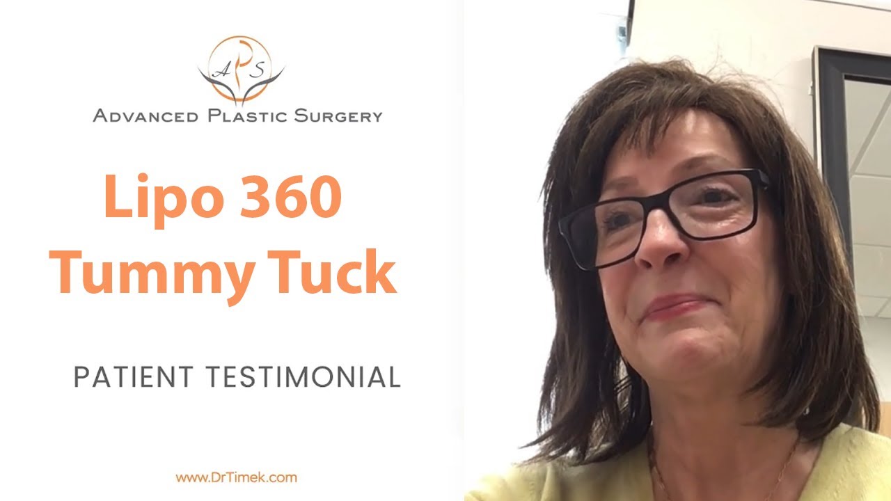 Patient Testimonial - LIPO 360, TUMMY TUCK - YouTube