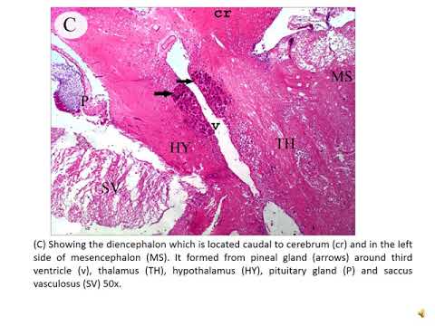 brain of fish (Histology) - YouTube