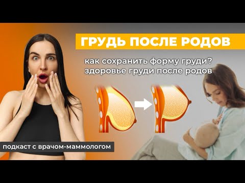 Грудь после родов: как вернуть форму? Птоз груди после ГВ. Рак молочной железы. Подкаст с маммологом