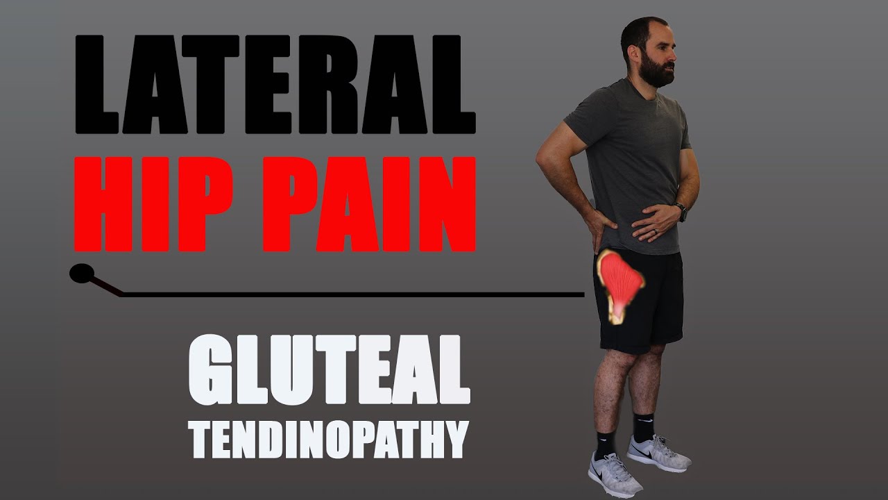 How to Relieve Persistent Lateral Hip Pain. Advance Exercises for ...