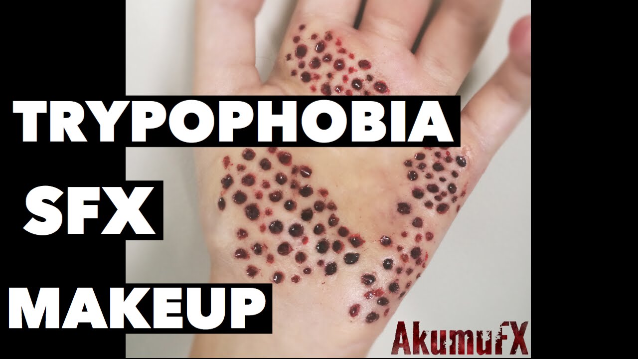 Trypophobia I SFX I Holes in Hand - YouTube