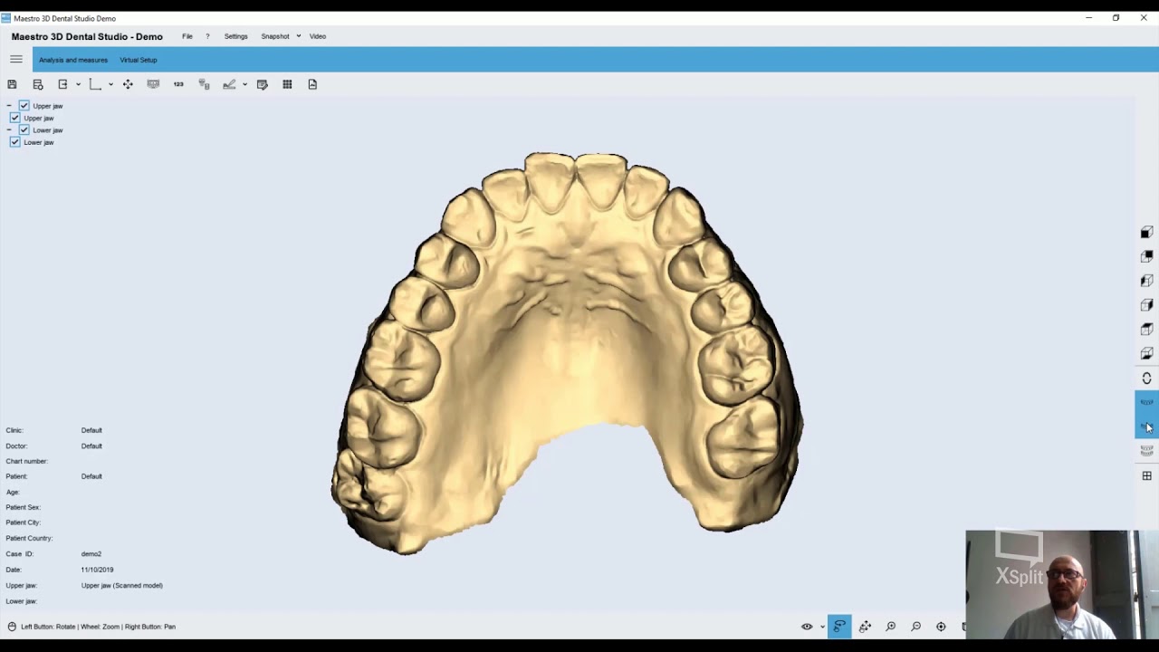7- LIVE Focus on Maestro 3D ortho design software - YouTube