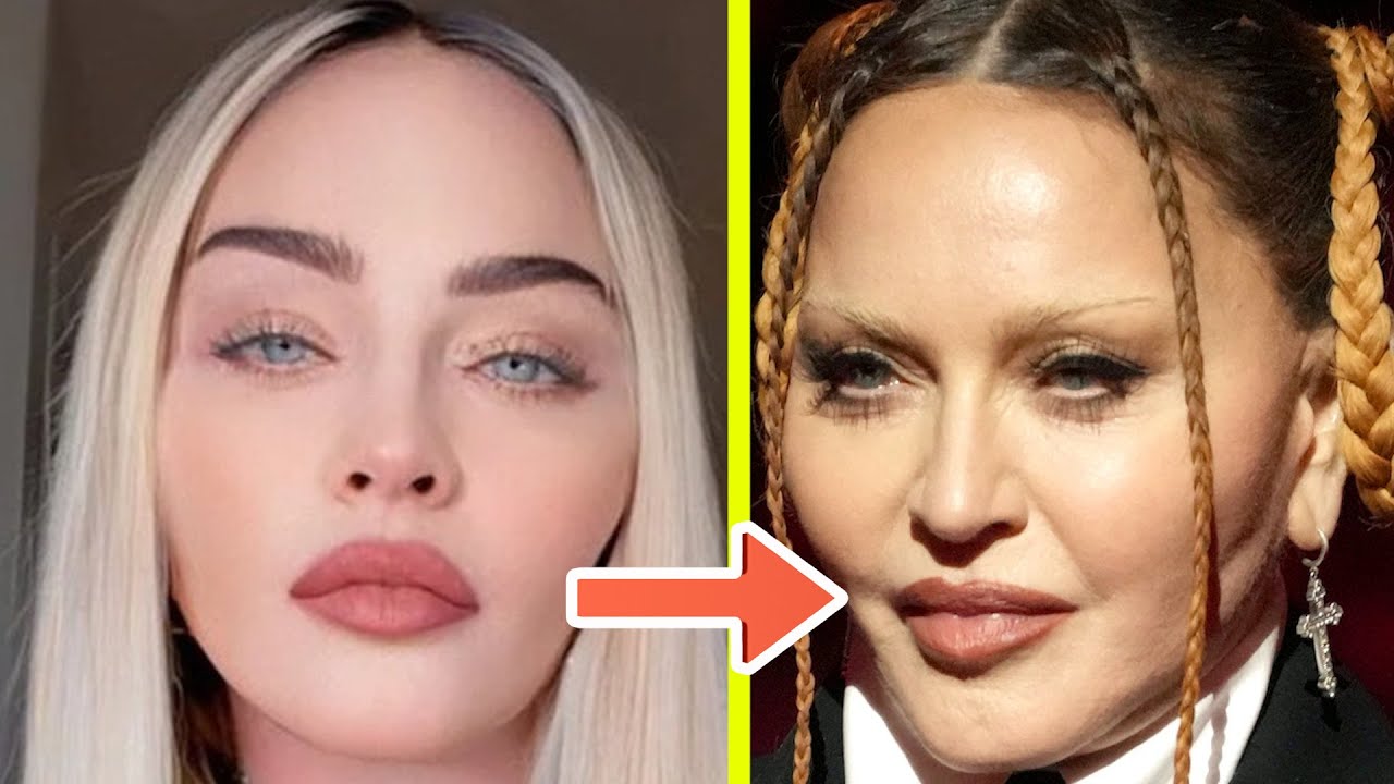 Madonna at Grammys 2023: WTF happened to her face?! | Opt into Beauty ...
