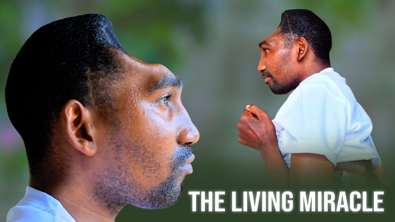 Miracle Man Living Without Most of His Brain Defies Odds ...